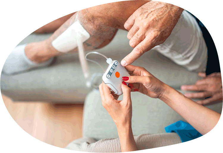 Open wounds | Possible with PICO